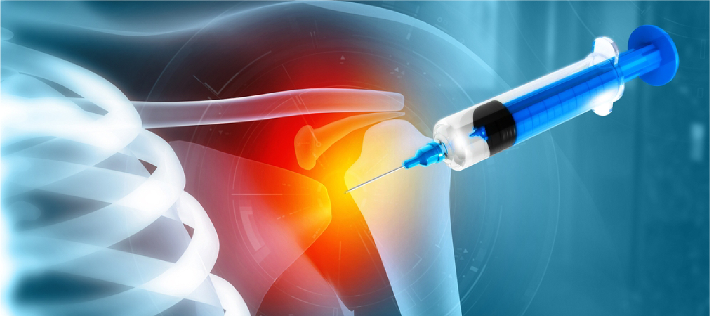 Shoulder Arthroscopy Recovery Time: What to Expect and How Long It ...