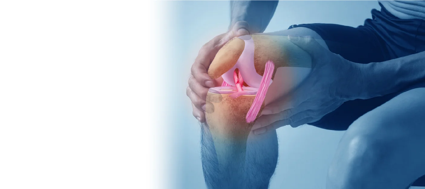 Step-by-Step Recovery from ACL Injury | ACL Surgery and Recovery Guide